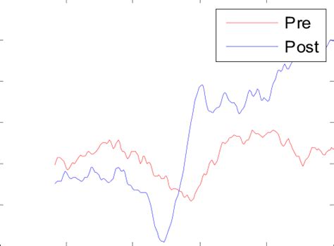 Somato Sensory Evoked Potential Of The Left Ulnar Nerve Note N20 Peaks