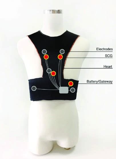 Iot Based Wearable Monitoring Structure For Detecting Abnormal Heart