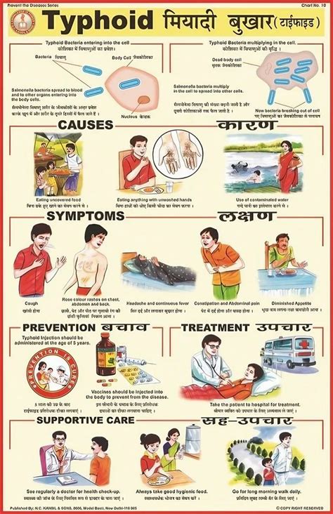 Multicolor Laminated Paper Typhoid For Prevent Diseases Chart Size 50x75 At Rs 96 In New Delhi