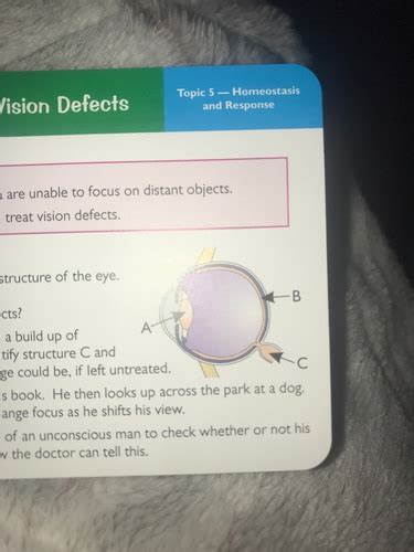 The Eye And Correcting Vision Defects Flashcards Quizlet