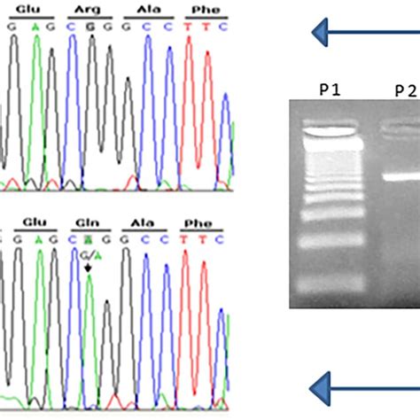 Sequencing Chromatograms For The C 242 G A Variant In Lrtomt Gene Download Scientific Diagram