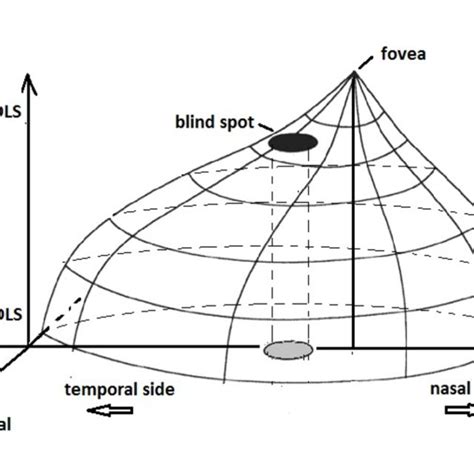 5 Schematic Illustration Of Different Types Of Glaucoma Defect Download Scientific Diagram