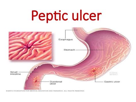 Git Ppt Power Point Presentation Cover Lecture Pptx