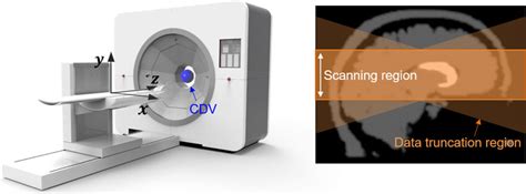 Illustration Of The G Spect I Scanner The Left Image When A