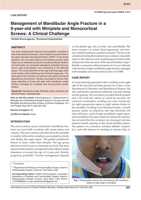 Pdf Management Of Mandibular Angle Fracture In A 9 Year Old With Miniplate And Monocortical