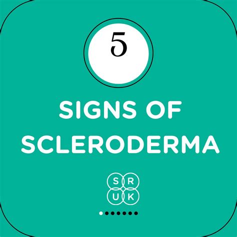 Scleroderma 🎗️ Its Scleroderma Awareness Month And Were Shining A Light On The Signs And