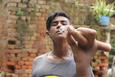 악마의 아이라 불리는 소년 태어날 때부터 안타까운 사연 헉스