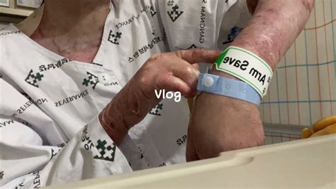 Vlog 제가 언제 퇴원을 한적이 있었나요 🤷🏻‍♀️ 희귀 피부병 희귀병브이로그 투병생활 수포성 표피박리증 Youtube