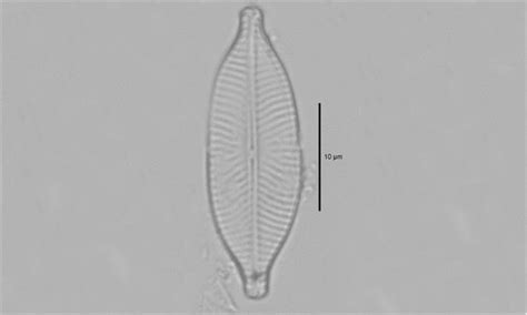 Navicula Salinarum Marine Biodiversity Portal Of Bangladesh
