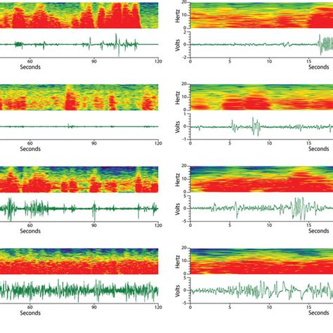 Optimizing Spectrogram To Visualize Respiration And Movement Data A Download Scientific