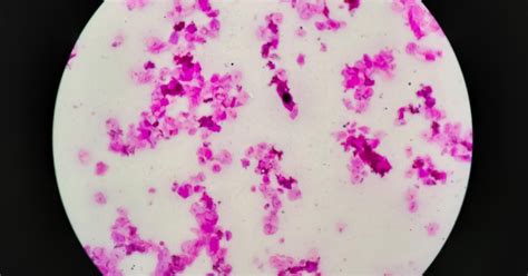 Does Toxoplasma Gondii Affect Humans Behind The Otter Killing Parasite