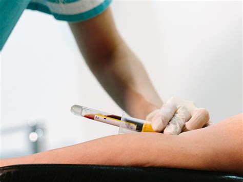 Heart Disease Good Hdl Cholesterol May Not Predict Risk