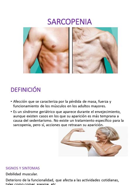Sarcopenia En Adultos Mayores Causas Y Síntomas Pdf