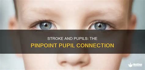 Stroke And Pupils The Pinpoint Pupil Connection Medshun