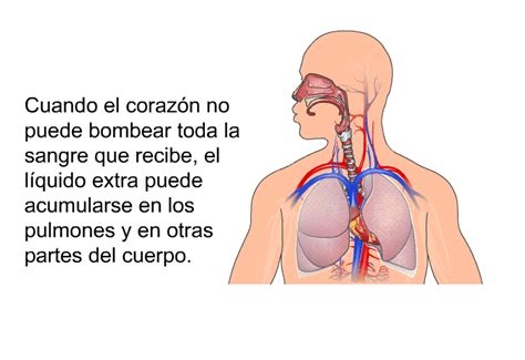 Insuficiencia Cardíaca