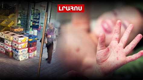 Արցախում ապրանքների առավելագույն գներ կսահմանվեն․ ՀՀ ում կարմրուկի 39 դեպք է հաստատվել․ Լուրեր