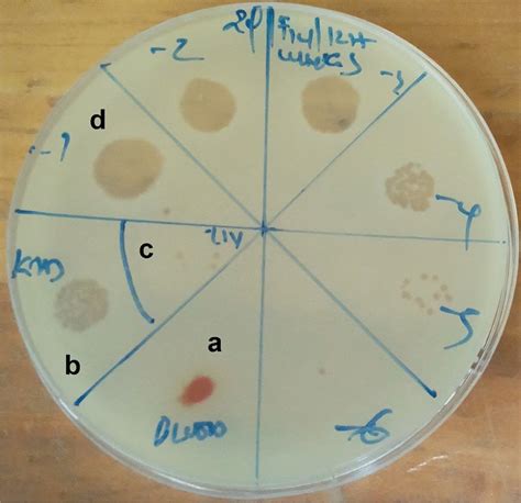 Spot Assay Displaying The Presence Of Viable Klebsiella Bacteriophages Download Scientific