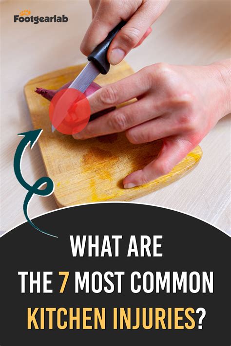What Are The 7 Most Common Kitchen Injuries Artofit