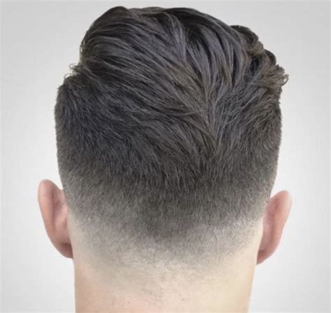 Double Crown Vs Balding Differences Symptoms Treatments