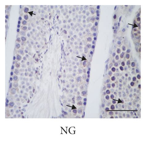 Ac Representative Image Of He Staining For Ng Vg And Vlg Group