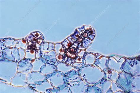 Fern Female Sex Organs Light Micrograph Stock Image C Science Photo Library