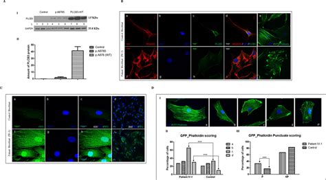 Defect In Phosphoinositide Signalling Through A Homozygous Variant In