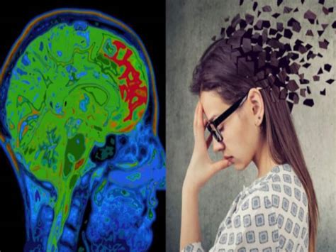 Early Signs And Symptoms Of Dementia Dementia Symptoms कम उम्र में भी