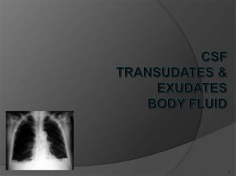 Csf Transudates Exudates Pptx