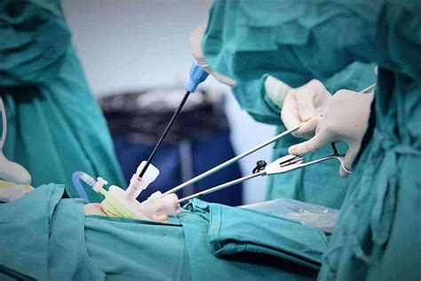 腹腔镜手术后多久可以怀孕听听医生怎么说 孕小帮