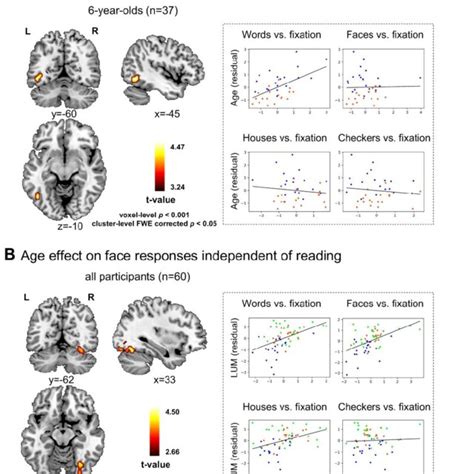 Regression Of Brain Activity With Reading And Age A Left Effect Of Regression Of Brain Activity With Reading And Age A Left Effect Of