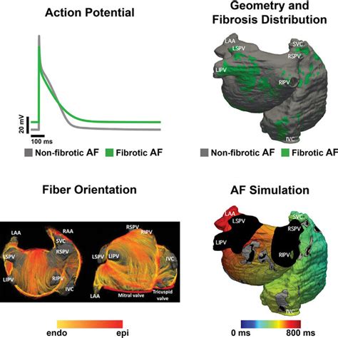 Whole Atria Computational Models Integrate Information From Cell To Download Scientific Diagram