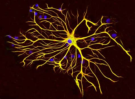 Snapshot What Are Astrocytes National Ataxia Foundation