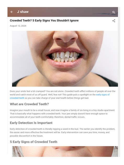 Crowded Teeth 5 Early Signs You Shouldnt Ignore Pdf Human Tooth