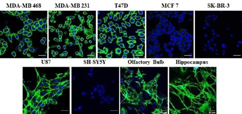 Cd44 Expression Levels For Different Cancer And Neural Cell Lines Download Scientific Diagram