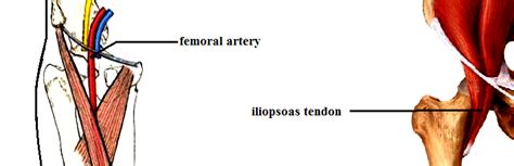 Mri Arthrogram Hip Protocol And Planning Indications For Mri Mri Arthrogram Hip Protocol And Planning Indications For Mri