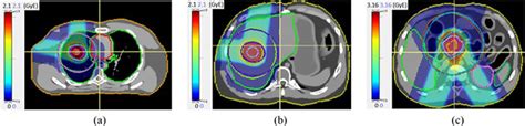 Flow Chart Of Operations Applied On Ct Image In Order To Quantify And