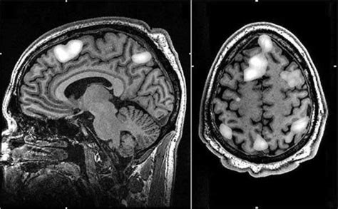Fmri Output Of A Participant Performing A Working Memory Task Download Scientific Diagram