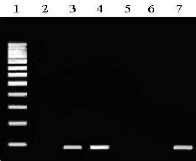 Gel Electrophoresis Of Sex Determination PCR Lane Shows Fermentas Download Scientific