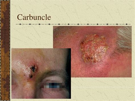Ppt Dermatology Primer Powerpoint Presentation Free Download Id 141906