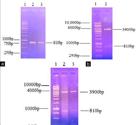 Development Of Recombinant Plasmid I And Its Confirmation A Lane 1 Download Scientific