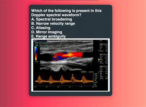 Ultrasound Physics Spi Exam Review Anki Flashcards Digital Download Etsy