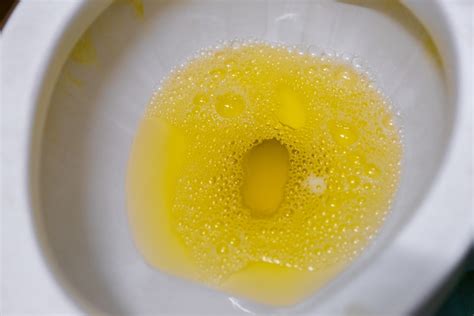 What Food Turns Pee Bright Yellow At Levi Gether Blog