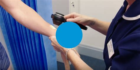 The Mole Clinic Skin Cancer Check And Mole Removal Specialists
