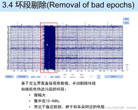 脑电信号处理与特征提取——4 脑电信号的预处理及数据分析要点（彭微微）
