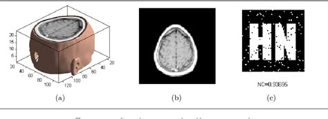 Figure 1 From Zero Watermarking Algorithm For Medical Volume Data Based On Difference Hashing