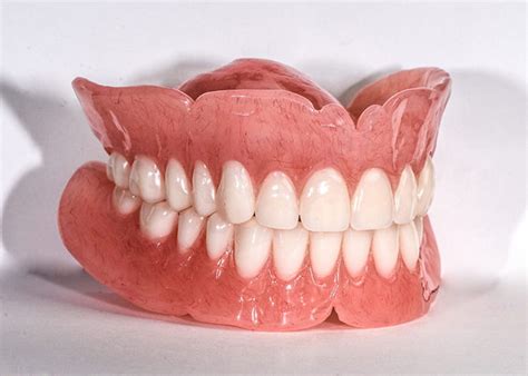 What Are The Different Types Of Denture Materials At Edward Gratwick Blog
