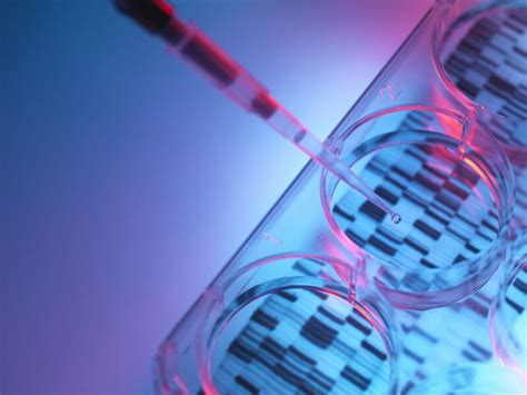 Rare Disease Advisor On Linkedin Genetic Testing To Diagnose Attr Cm In Hf Arrhythmia Key To