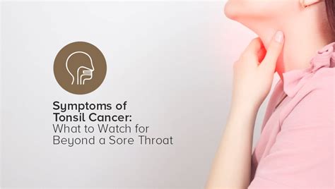 Symptoms Of Tonsil Cancer Key Signs Beyond A Sore Throat