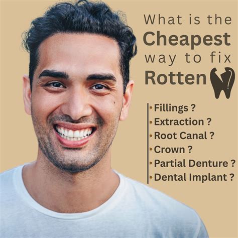 Rotten Teeth Solutions Your Complete Guide To Fixing Bad Teeth Darya