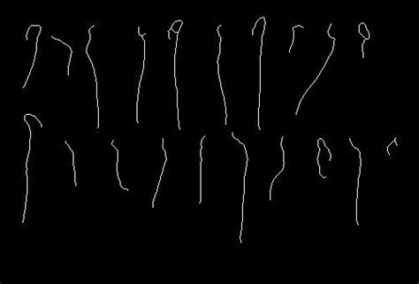 How To Perform An Automated Image Analysis Of Skeleton Length In Imagej Researchgate